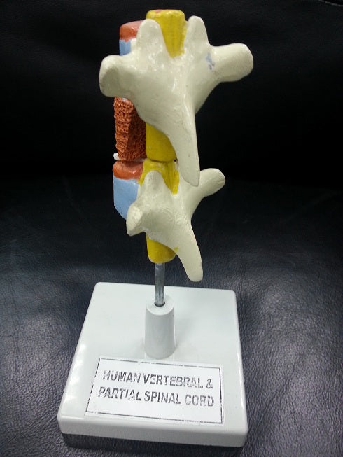 Vertebral & Partial Spinal Cord Model (On Stand) – Skyline Educational Labs