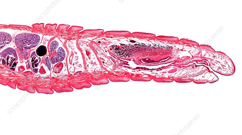 Earthworm Cross Section Under Microscope