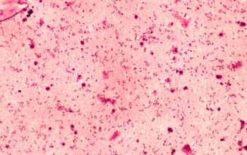 Rhizobium Bacteria Microscope Frontiers | The Abundance Of Endofungal